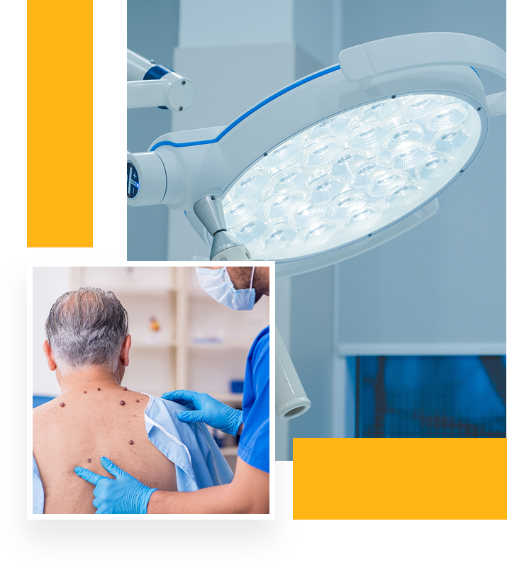 Skin Cancer Surgery Sunshine Coast | Visit SunLife Care Centre